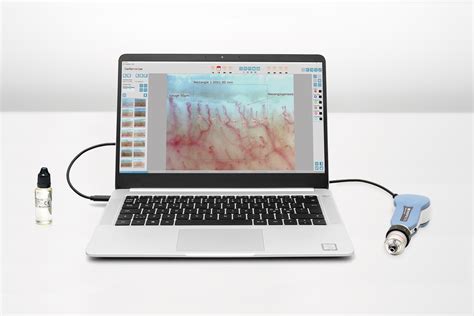 Capiscope Range Capillaroscopy