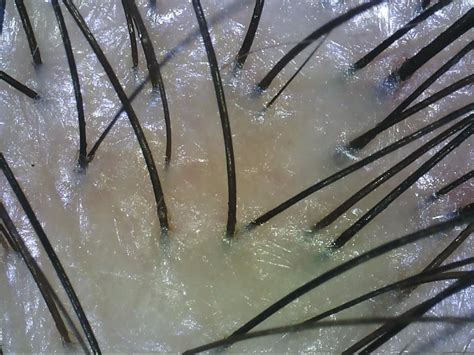 Ultimate Density Scalp Restorer Juliart