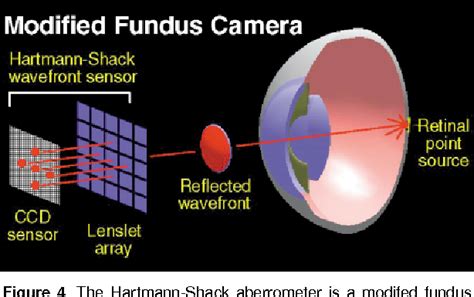 Figure 1 From Principles Of Hartmann Shack Aberrometry Semantic Scholar