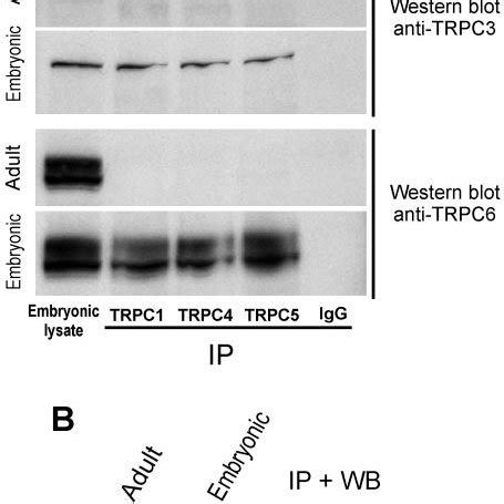 TRPC TRPC And TRPC Interact With TRPC And TRPC In Rat Brain A Download Scientific