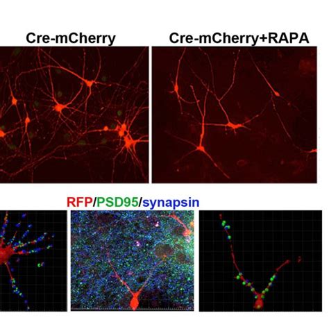 Loss Of Pten In Post Mitotic Cortical Interneurons Enhances