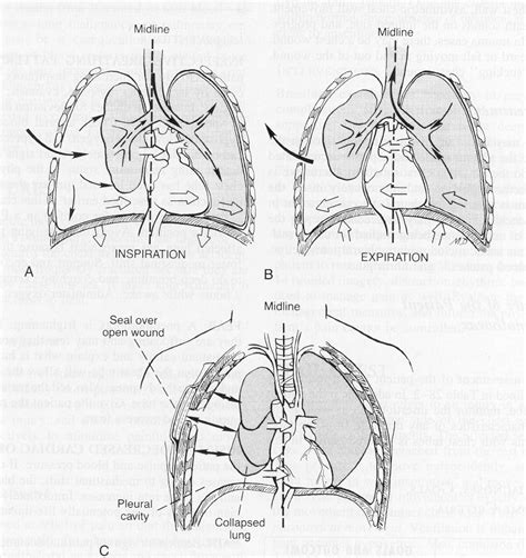 Solved What Clinical Symptoms Or Findings Are Associated