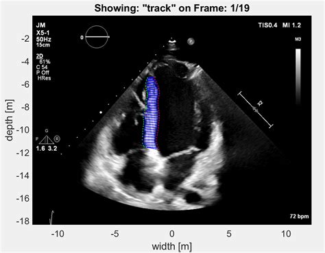 Image Processing How Do I Determine The Displacement Between Two