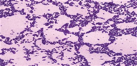 Advanced Biomedical Research