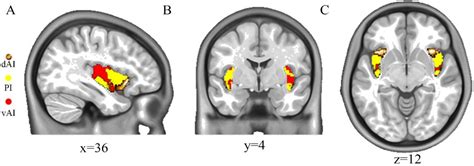 Insular Cortex Fmri