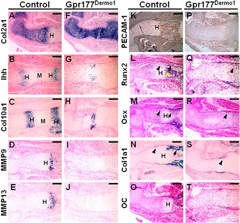 Gpr177 A Novel Locus For Bone Mineral Density And Osteoporosis