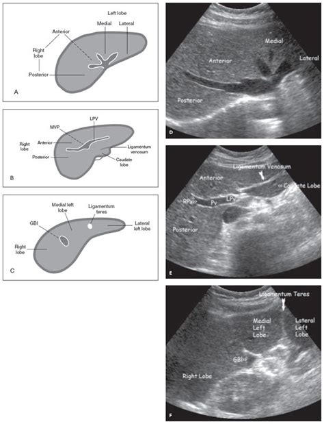 Ultrasound Anatomy Abdomen Abdominal Ultrasound Scan Ultrasound Scan Ultrasound Anatomy Abdomen Abdominal Ultrasound Scan Ultrasound Scan