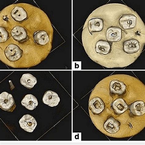 Different Types Of Access Cavity Preparation A Truss Access Cavity Download Scientific Diagram