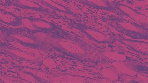 Psoriasis Learning Zone Medthority