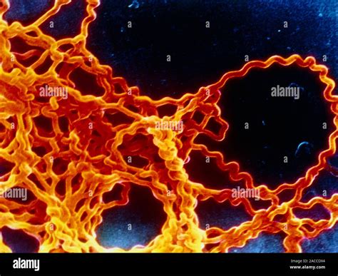 False Colour Scanning Electron Micrograph Of Leptospira Sp Bacteria Leptospira Is One Of A
