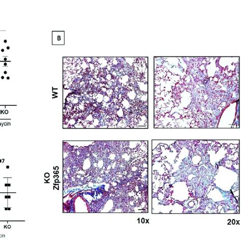 An Exacerbated Fibrotic Response Was Observed In Zfp365 Deficient Mice