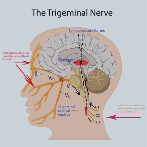 Head Neck Facial Pain Known As Craniofacial Pain Syndrome