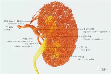 肾动脉狭窄的超声诊断标准！！！ 知乎