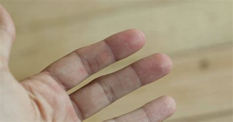 Cervical Mucus Stages And Tracking