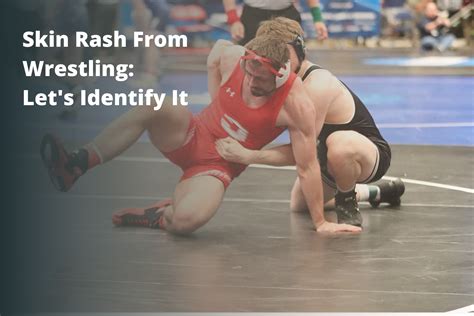 Wrestling Mat Rash At John Mccloud Blog