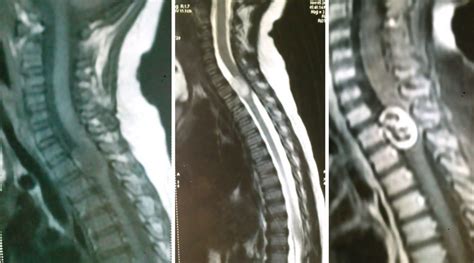Preoperative Mri Images Download Scientific Diagram