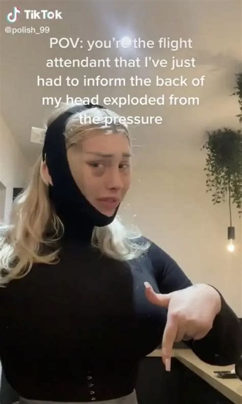 Womans Head Explodes During Surgery At Karen Medina Blog