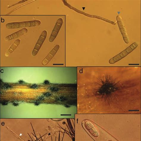 Life Cycle Of Pyrenophora Teres F Teres And P Teres F Maculata
