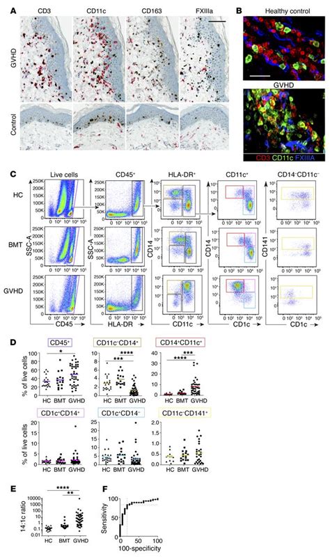 JCI Donor Monocytederived Macrophages Promote Human Acute Graft Versus Host Disease