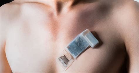 A Giant Leap Forward In Wireless Ultrasound Monitoring For Subjects In