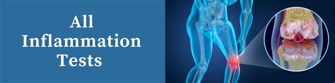 Inflammation Tests What To Order When Ulta Lab Tests