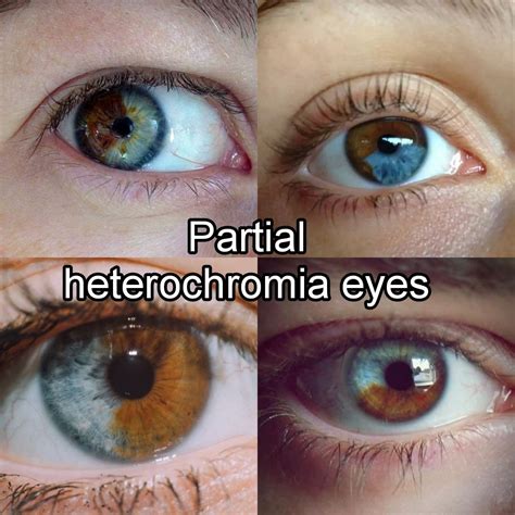 Partial Heterochromia Eyes 💙🤎💚💛 Eye Color Chart Pretty Eyes Color
