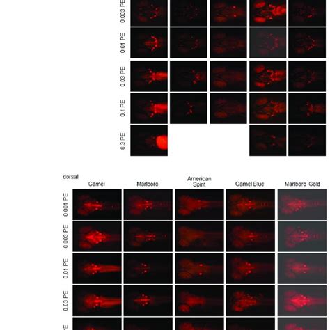 Quantitative Morphometric Scoring Of Bone Mineralization Defects In