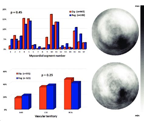 Automated Localization Of The Reversible Perfusion Defect Left Download Scientific Diagram