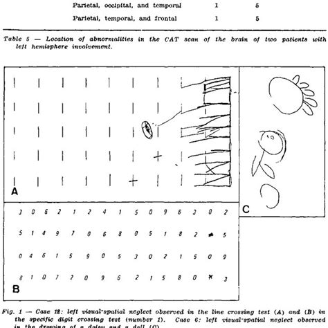 Bell Test Visual Neglect At Caleb Fernando Blog