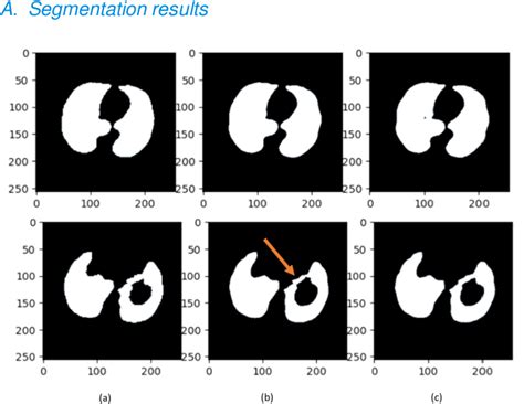 Figure 6 From An Automated End To End Deep Learning Based Framework For