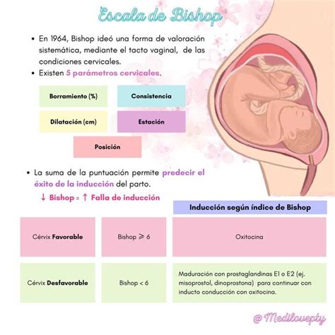 Escala De Bishop Medilove Udocz