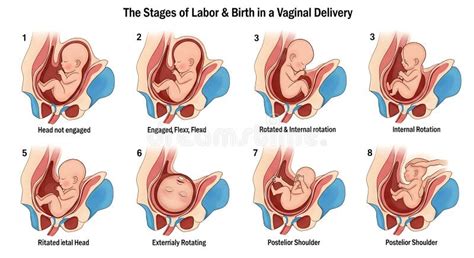 Stagesoflabor Stock Illustrations 2 Stagesoflabor Stock Illustrations