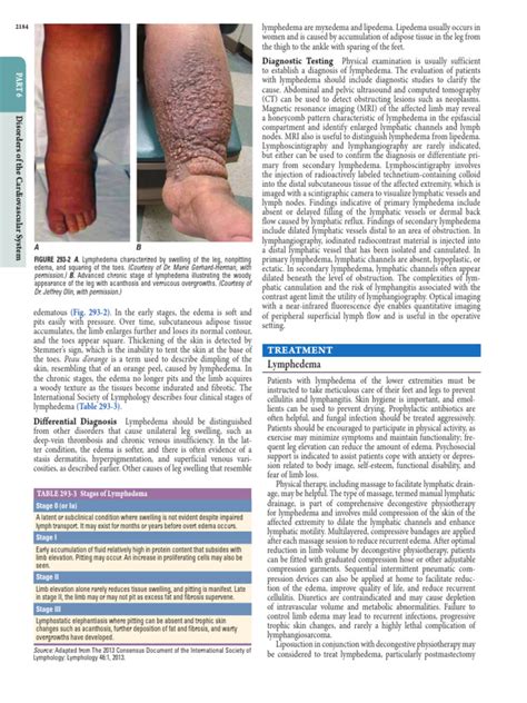 Understanding Lymphedema Stages And Treatment Pdf Edema Diseases
