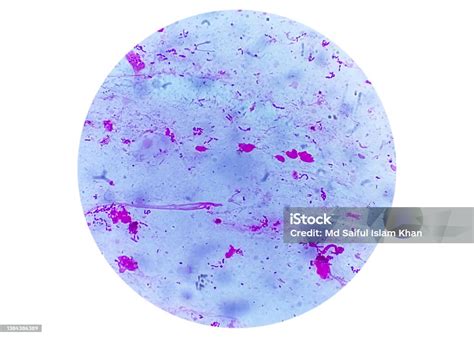 What Are Squamous Epithelial Cells In Gram Stain At Jeffery Thompson Blog