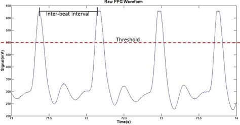 Ppg Signal Waveform Download Scientific Diagram