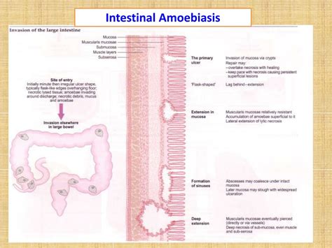 Ppt Understanding Amoebiasis Parasitic Infection Overview Powerpoint