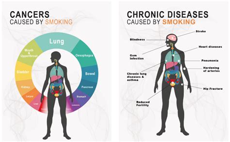 Smoking And Lung Cancer Whats My Risk