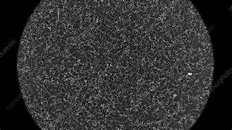 Spirochete Bacteria Light Micrograph Stock Image C0609248