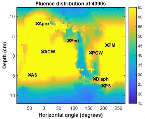Fluence Distribution Map For A Representative Patient Case No 020