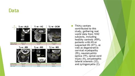 Automatic Segmentation Of The Spinal Cord And Intramedullary