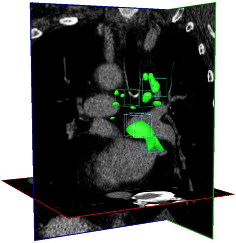 Detection Results On Unseen Data Shown In 3 D Along With Ground Truth