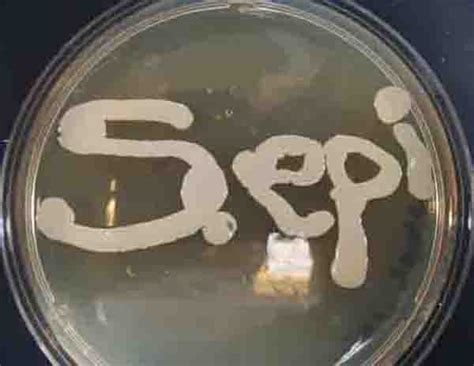 Staphylococcus Epidermidis Streak Plate
