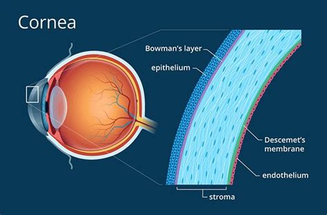 Corneal Ulcers Nurses Revision