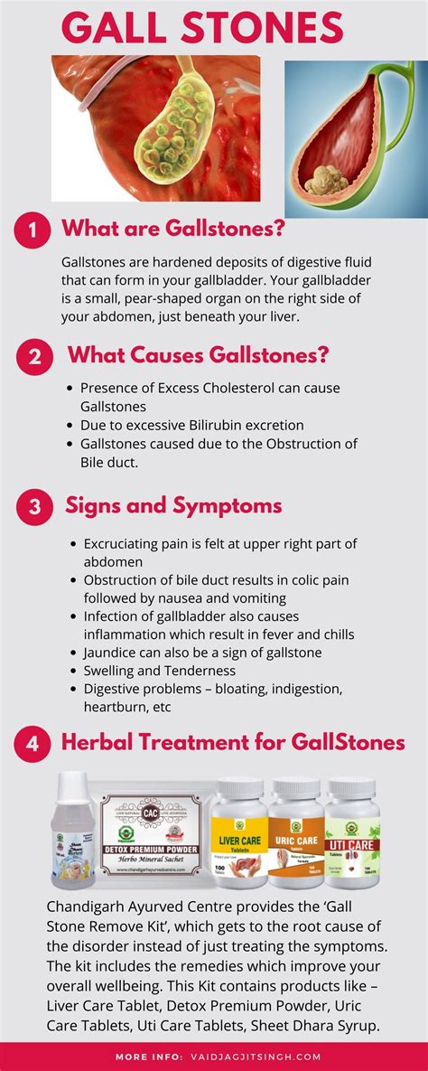 Gall Stones Causes Symptoms And Herbal Treatment Artofit
