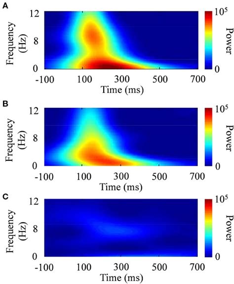 typical examples of time frequency responses after the wavelet