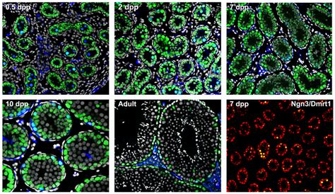 Dmrt1 And Oct4 Expression During Postnatal Development Of The Mouse
