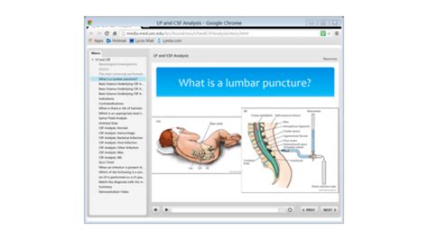 Module CSF Analysis Flashcards Quizlet