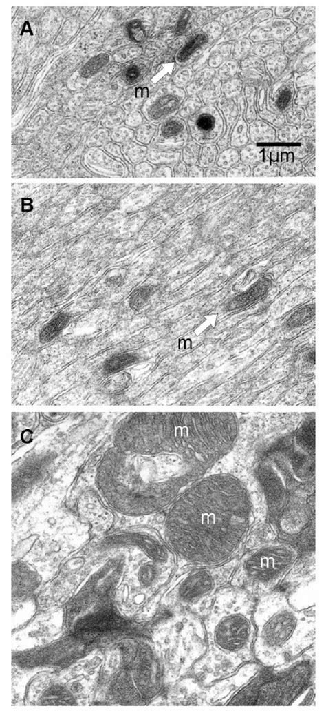 Electron Micrographs Illustrating The Density And Properties Of