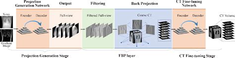 Figure 1 From Deep Learning Single View Computed Tomography Guided By Fbp Algorithm Semantic