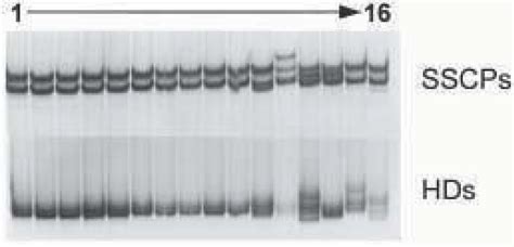 Sscpheteroduplex Hd Analysis Of Cftr Exon 3 309 Bp Lanes 1 10 Are Download Scientific